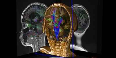 Convert Your Legacy OpenGL Code to Modern OpenGL with Qt - On-Demand ...